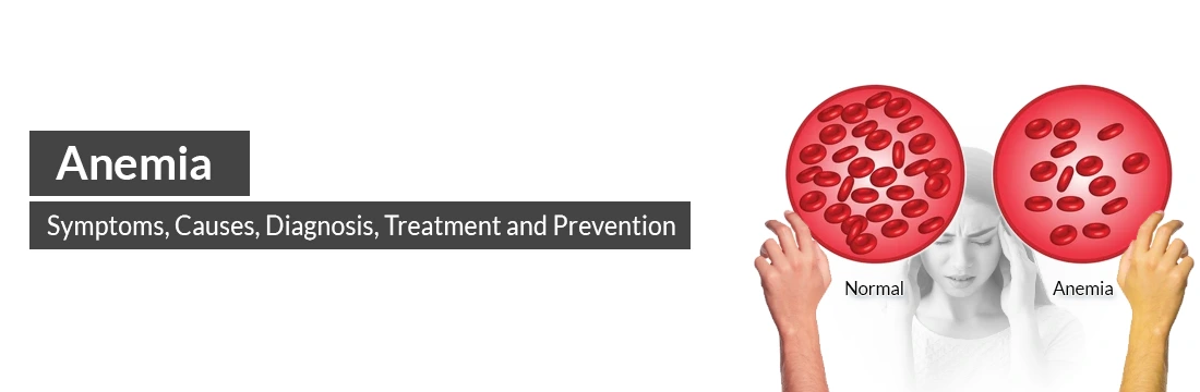 RBC Count High, Good, or Bad? Symptoms, Causes and Prevention