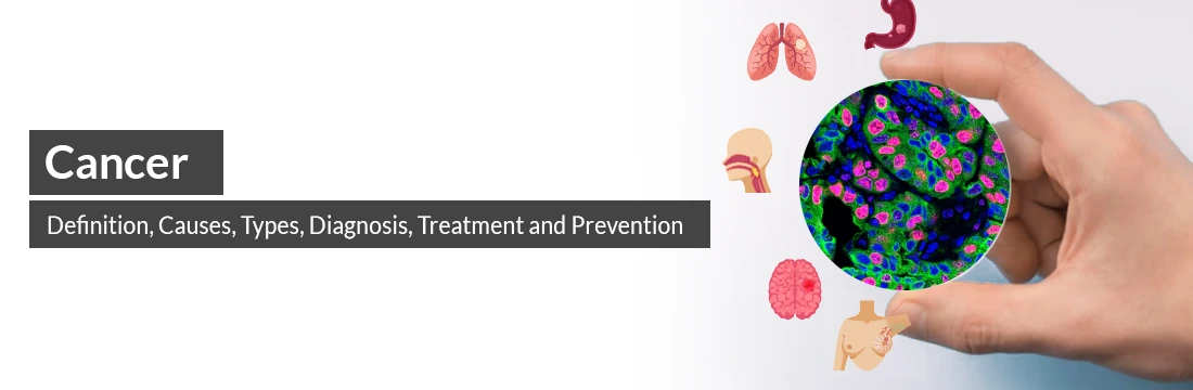 Cancer: Causes, Types, Diagnosis, Treatment and Prevention