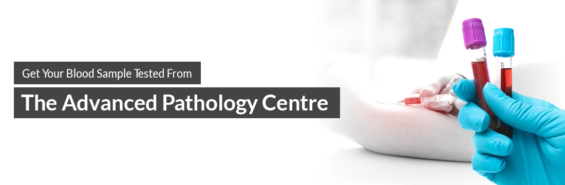 Get Your Blood Sample Tested From the Advanced Pathology Centre
