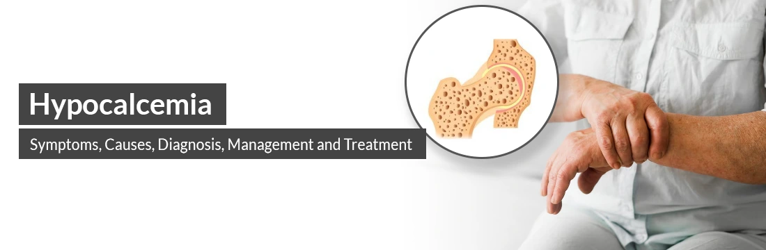 Hypocalcemia: Symptoms, Causes, Diagnosis, Management and Treatment