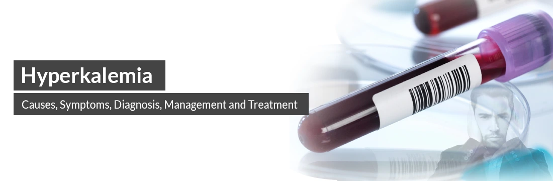 Hyperkalemia: Causes, Symptoms, Diagnosis, Management and Treatment