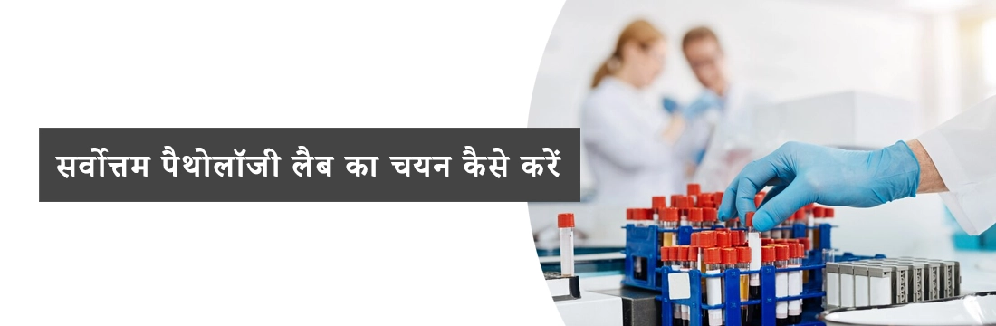 सर्वोत्तम पैथोलॉजी लैब का चयन कैसे करें | How to Choose the Best ...