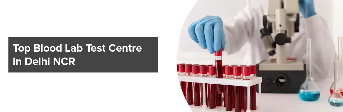 Top Blood Lab Test Centre in Delhi NCR | Ganesh Diagnostic