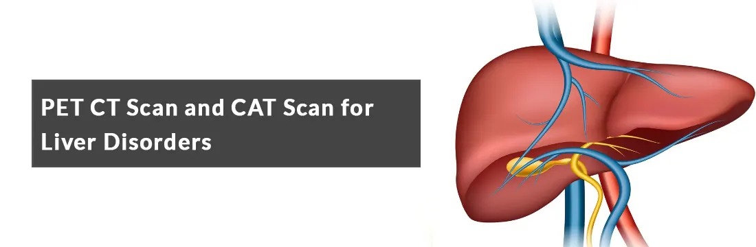 PET CT Scan and CAT Scan for Liver Disorders | Ganesh Diagnostic