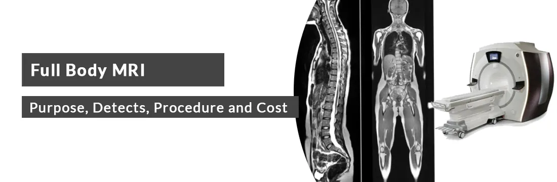 Full Body MRI: Purpose, Detects, Procedure, Cost and Best MRI Centre in ...