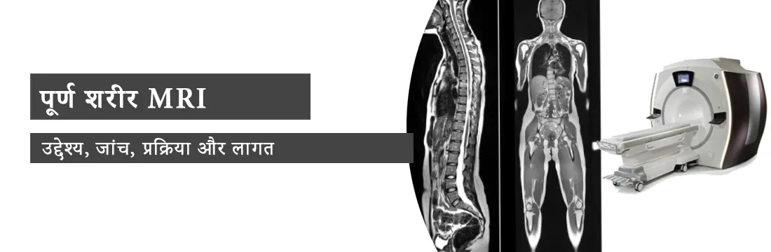 पूर्ण शरीर MRI: उद्देश्य, जांच, प्रक्रिया, लागत और दिल्ली में ...