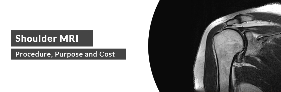 Shoulder MRI: Purpose, Procedure, Cost and Best MRI Centre