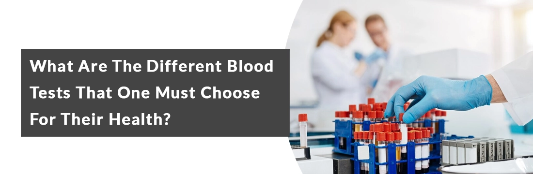 What Are the Different Blood Tests That One Must Choose for Their Health?