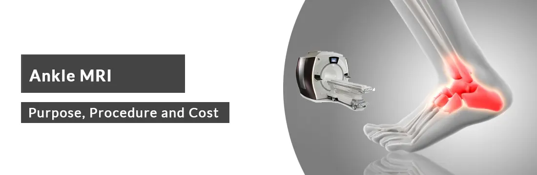 Ankle MRI: Purpose, Procedure, Cost and Best MRI Centre