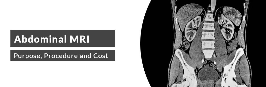 Abdominal MRI: Purpose, Procedure, Cost and Best MRI Centre
