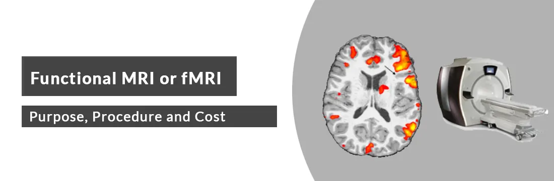 Functional MRI or fMRI: Purpose, Procedure, Cost and Best MRI Centre