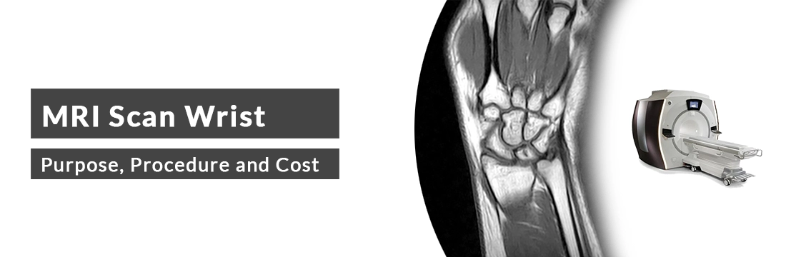 MRI Scan Wrist: Purpose, Procedure, Cost and Best MRI Centre
