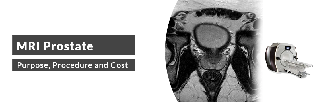 MRI Prostate: Purpose, Procedure, Cost and Best MRI Centre | Ganesh ...