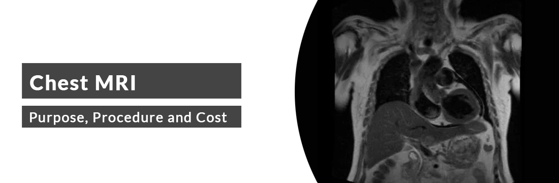 Chest MRI: Purpose, Procedure, Cost and Best MRI Centre | Ganesh Diagnostic