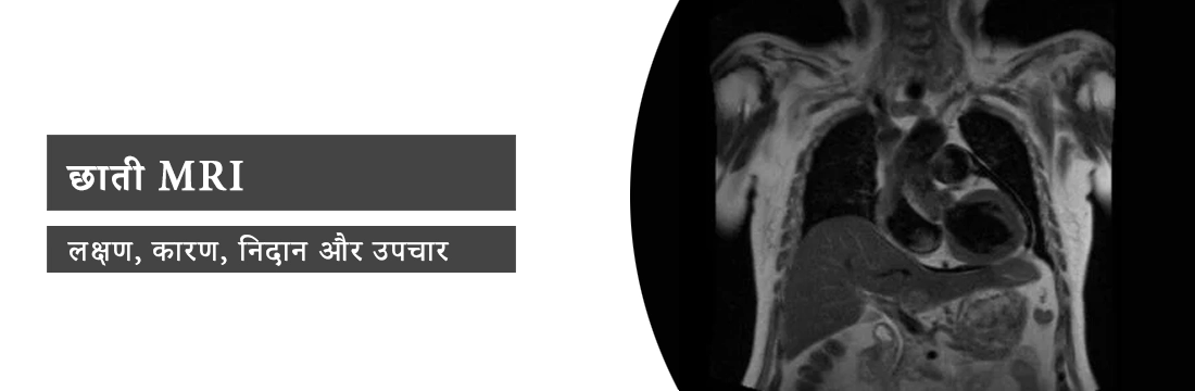 Chest MRI in Hindi: छाती MRI: उद्देश्य, प्रक्रिया, लागत और सर्वोत्तम ...