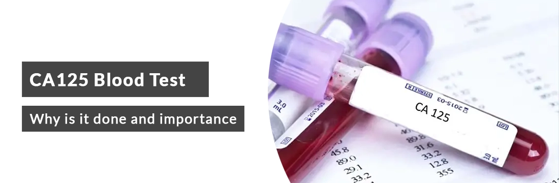 CA 125 Test - Why is It Done, Why is It Necessary, Know