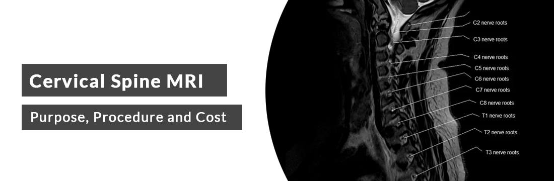 Cervical Spine MRI: Purpose, Procedure, Cost and Best MRI Centre