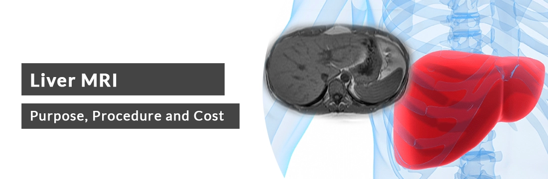 Liver MRI: Purpose, Procedure, Cost and Best MRI Centre in Delhi