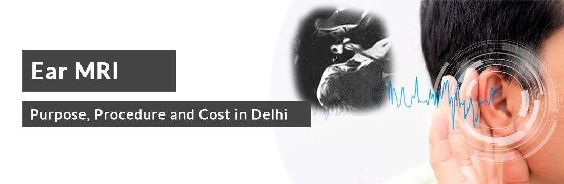Ear MRI: Purpose, Procedure, Cost in Delhi/ Noida/ NCR | Ganesh Diagnostic