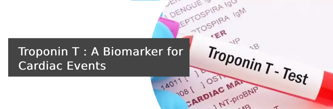 Troponin T : A Biomarker for Cardiac Events | Ganesh Diagnostic