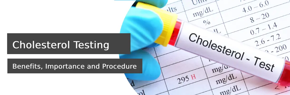 Cholesterol Testing: Benefits, Importance, Procedure, Cost of ...