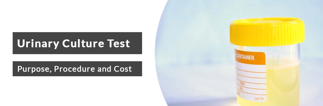 Urinary Culture Test: Procedure and Purpose | Ganesh Diagnostic