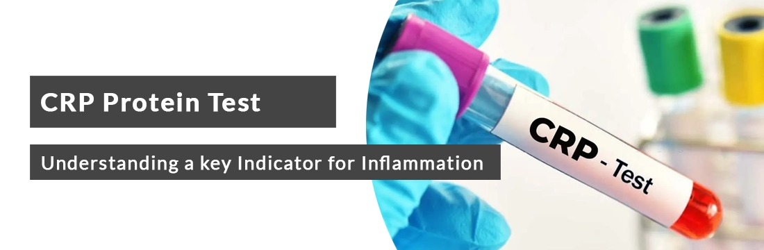 CRP Protein Test: Understanding a key Indicator for Inflammation