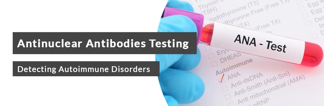 Antinuclear Antibodies Testing: Detecting Autoimmune Disorders