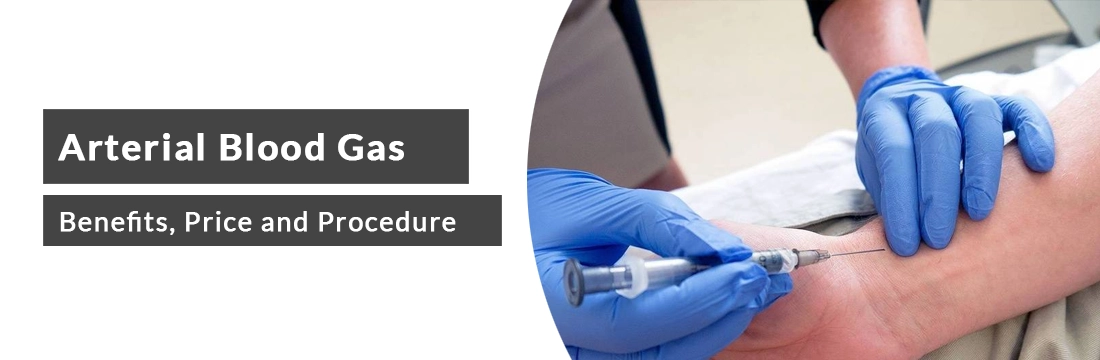 Arterial Blood Gas: Benefits, Price and Procedure | Ganesh Diagnostic