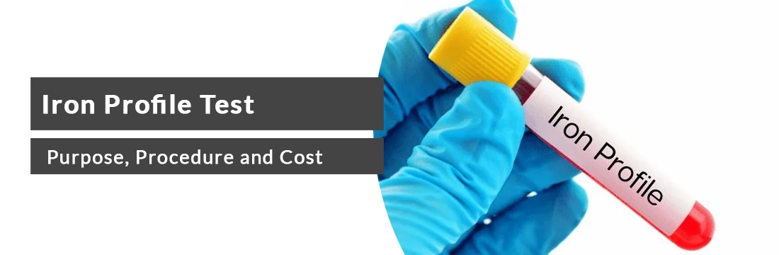 Iron Profile Test: Cost, Preparation and Procedure | Ganesh Diagnostic