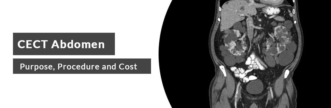 CECT Abdomen: Purpose, Procedure and Cost | Ganesh Diagnostic
