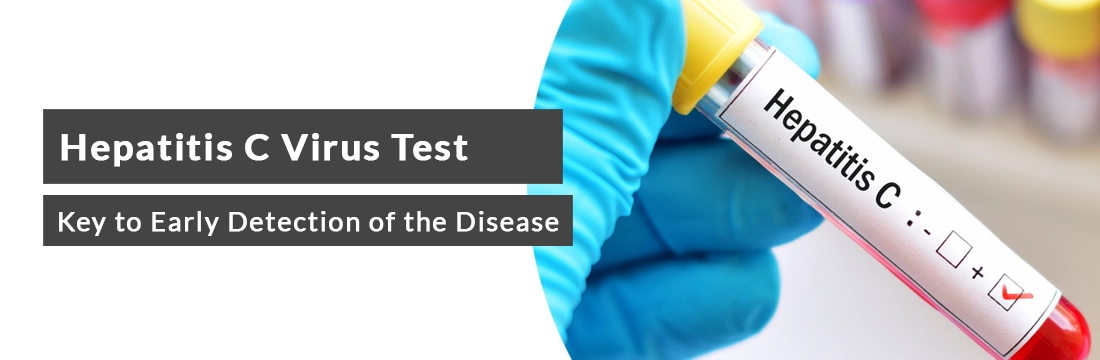 Hepatitis C Virus Test: Key to Early Detection of the Disease | Ganesh ...
