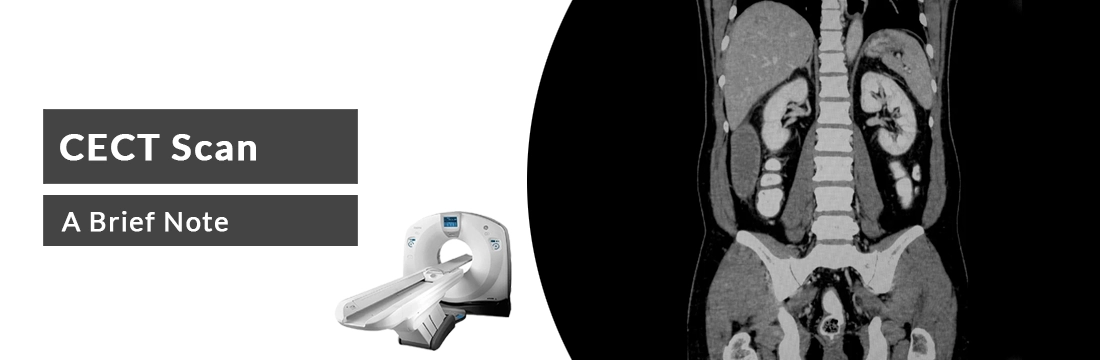 CECT Scan: A Brief Note | Ganesh Diagnostic