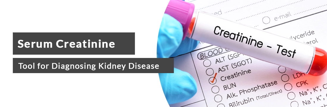 Serum Creatinine : Tool for Diagnosing Kidney Disease | Ganesh Diagnostic