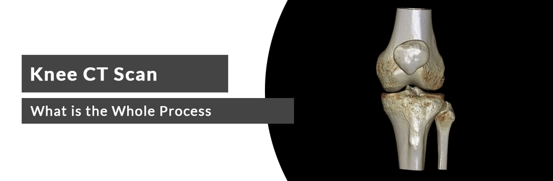 Knee CT Scan: What is the Whole Process | Ganesh Diagnostic