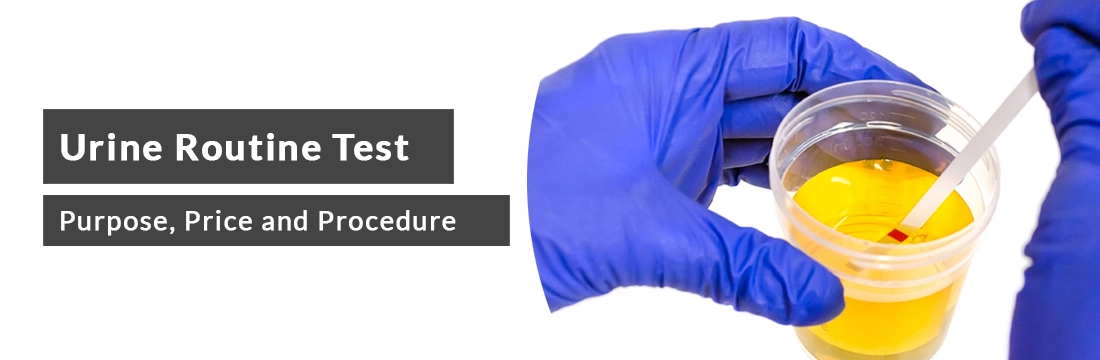 Urine Routine Test: Purpose, Price and Procedure | Ganesh Diagnostic