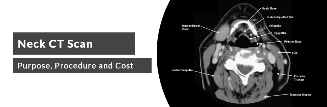 Neck CT Scan: Purpose, Procedure and Cost | Ganesh Diagnostic