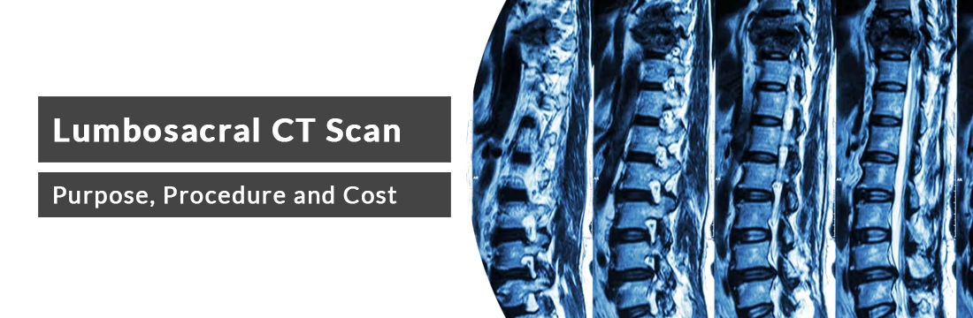 Lumbosacral CT Scan: Purpose, Procedure and Cost | Ganesh Diagnostic