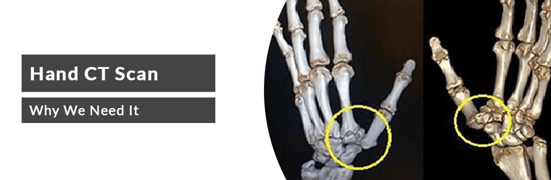 Hand CT Scan: Why We Need It | Ganesh Diagnostic