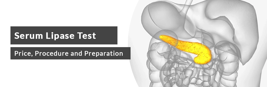 Serum Lipase test : Price ,Procedure and Preparation | Ganesh Diagnostic
