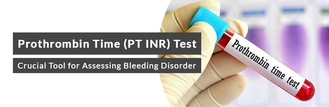 Prothrombin Time (PT INR) Test: Crucial Tool for Assessing Bleeding ...