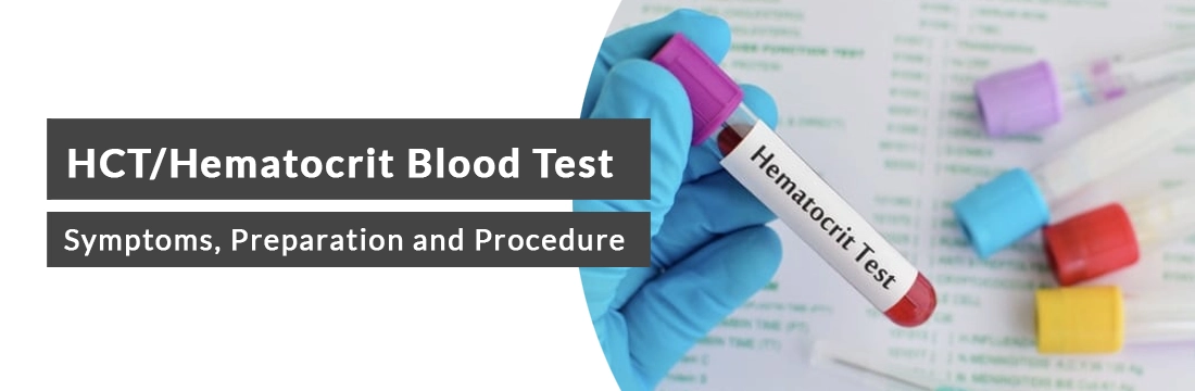 HCT Blood Test: Symptoms, Preparation and Procedure | Ganesh Diagnostic