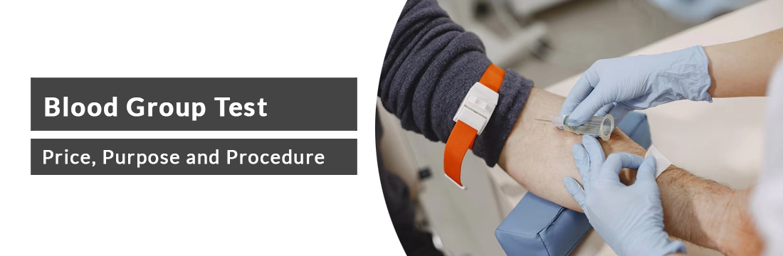 Blood Group Test: Everything You Need to Know | Ganesh Diagnostic