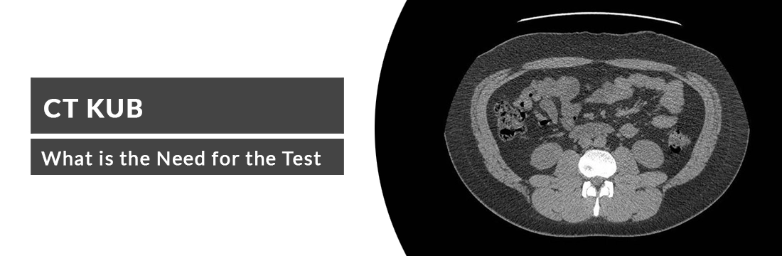 What is the Need for the CT KUB Test | Ganesh Diagnostic