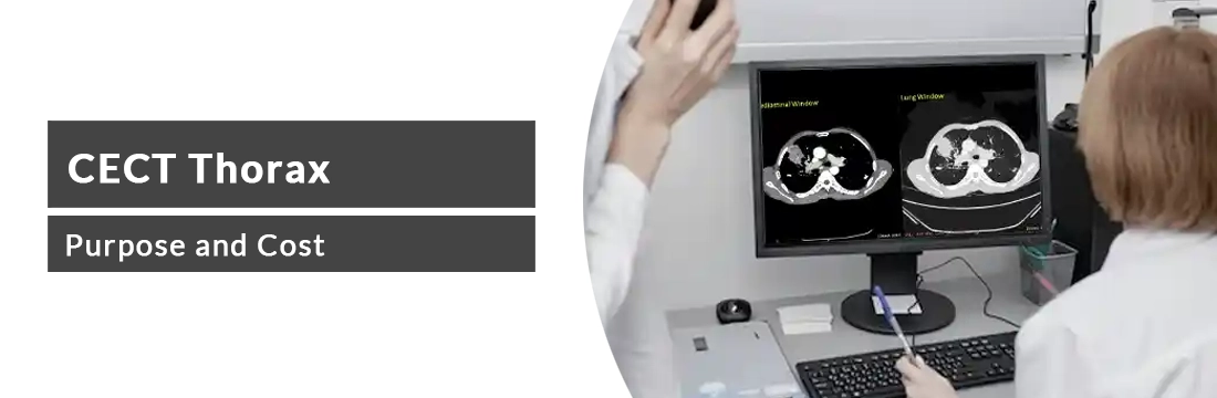 CECT Thorax Purpose and Cost | Ganesh Diagnostic