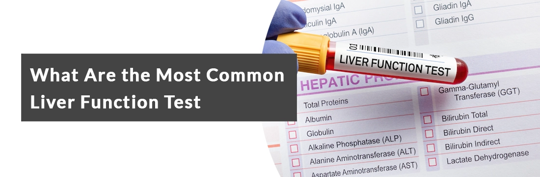 What Are the Most Common Liver Function Test | Ganesh Diagnostic