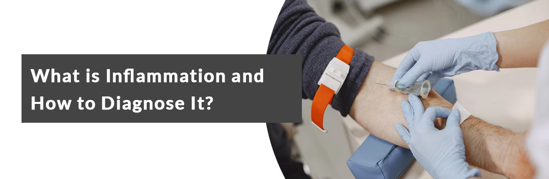 What is Inflammation and How to Diagnose It | Ganesh Diagnostic