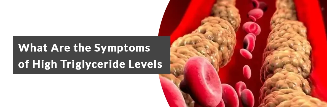 What Are the Symptoms of High Triglyceride Levels? | Ganesh Diagnostic