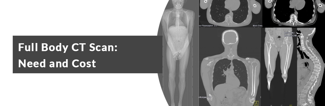 Full Body CT Scan: Need and Cost | Ganesh Diagnostic