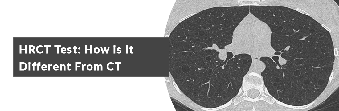 HRCT Test: How is It Different From CT | Ganesh Diagnostic